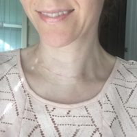 Testimonials and Great Stories From Thyroid Patients of Gary Clayman, MD.