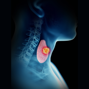 Clayman Thyroid Center and Thyroid Surgery Resource