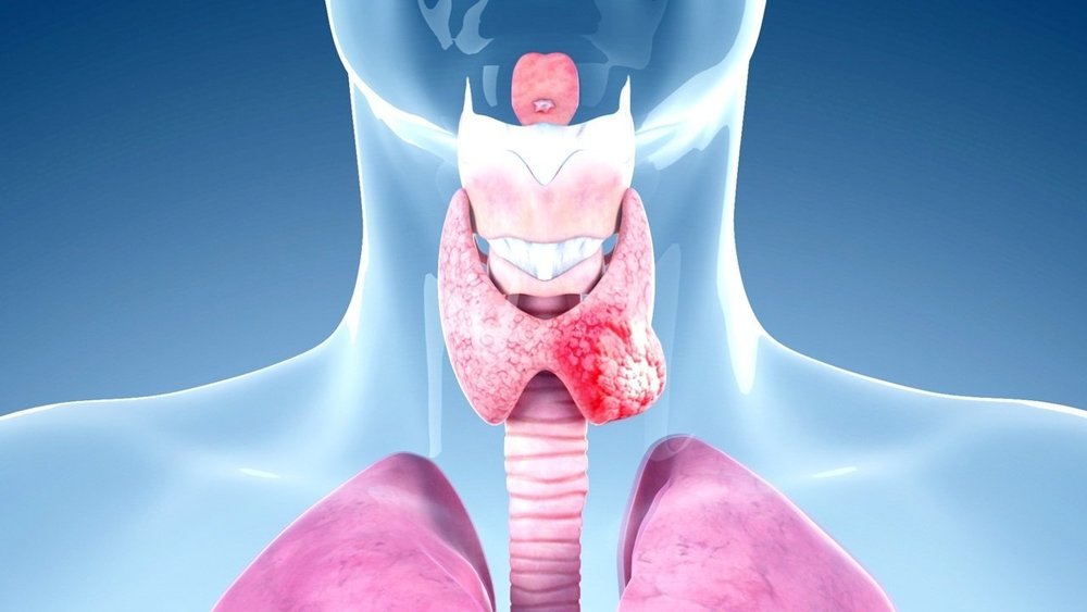 Thyroid Cancer Treatment: Your Guide to the Best Options for a Cure