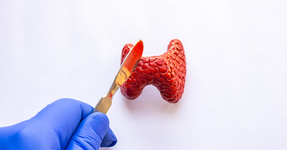 Understanding Tall Cell Variant of Papillary Thyroid Cancer